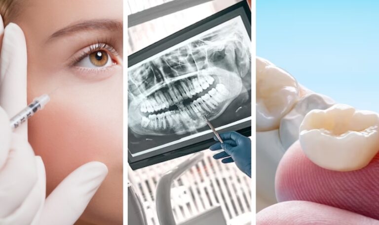 Five Types Of Cosmetic Dentistry Procedures